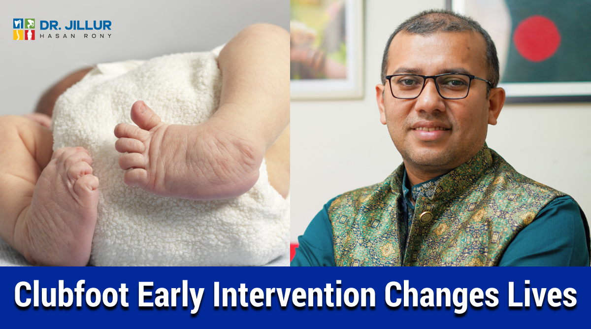 Is It Possible to Straighten Child’s Congenital Clubfoot? Treatment Methods